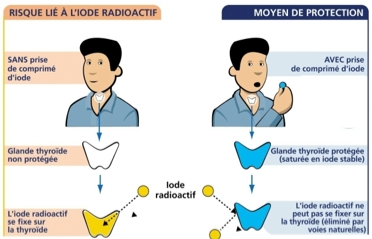 pastille d'iode ou acheter